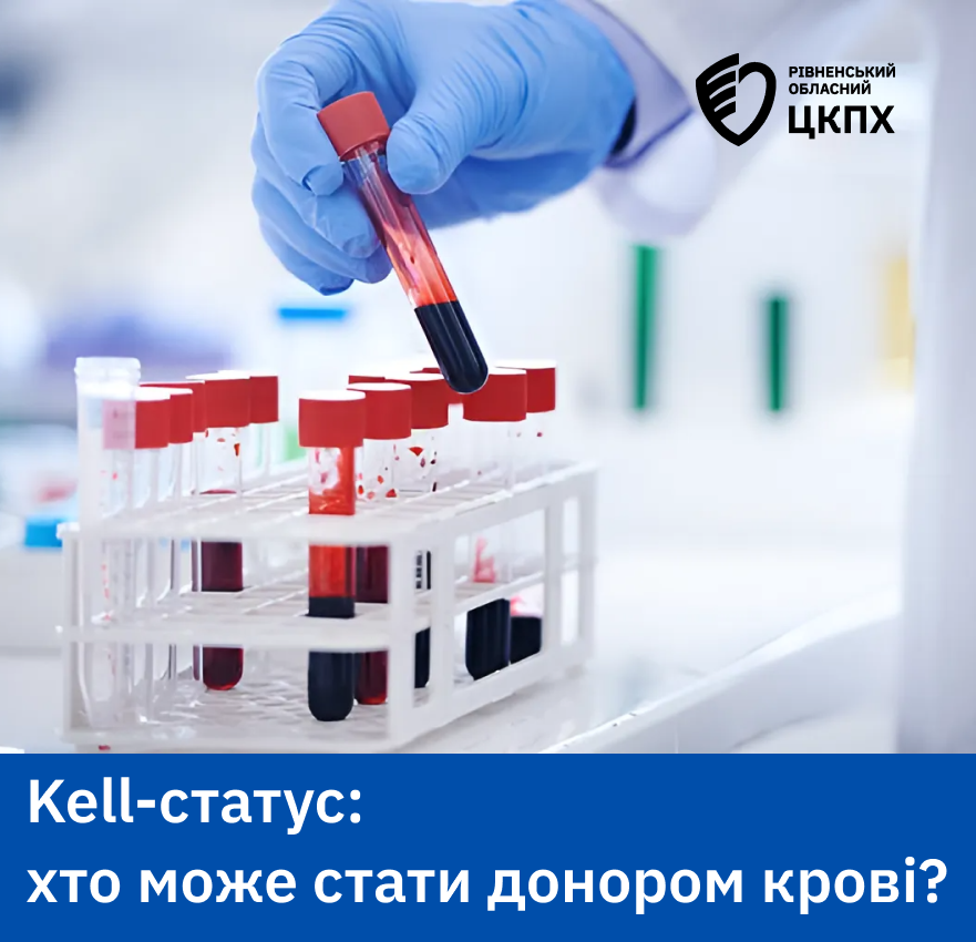 Kell-статус: хто може стати донором крові? - Новини - Рівненський ...